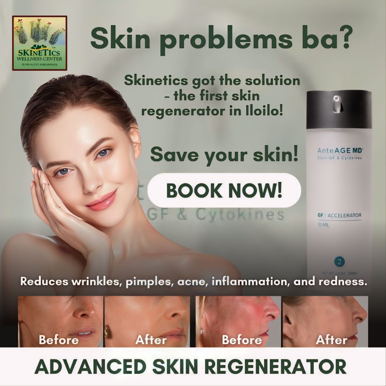 First in Iloilo - Discover Skinetics' Newest Breakthrough in ...
